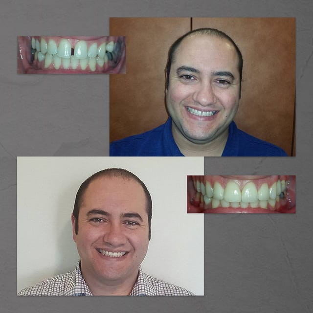 Advanced Dentistry by Soboh Liswi Tedini | Pomona