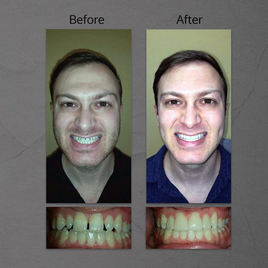 Advanced Dentistry by Soboh Liswi Tedini | Pomona