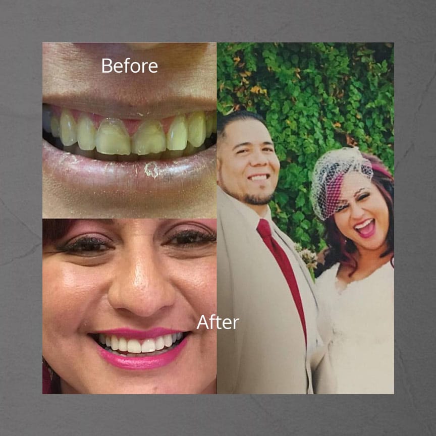 Advanced Dentistry by Soboh Liswi Tedini | Pomona