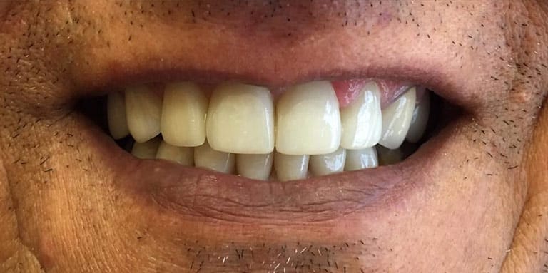 Advanced Dentistry by Soboh Liswi Tedini | Pomona