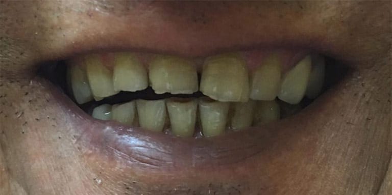 Advanced Dentistry by Soboh Liswi Tedini | Pomona