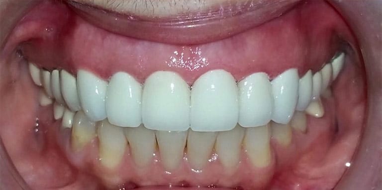 Advanced Dentistry by Soboh Liswi Tedini | Pomona