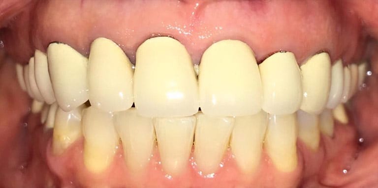 Advanced Dentistry by Soboh Liswi Tedini | Pomona