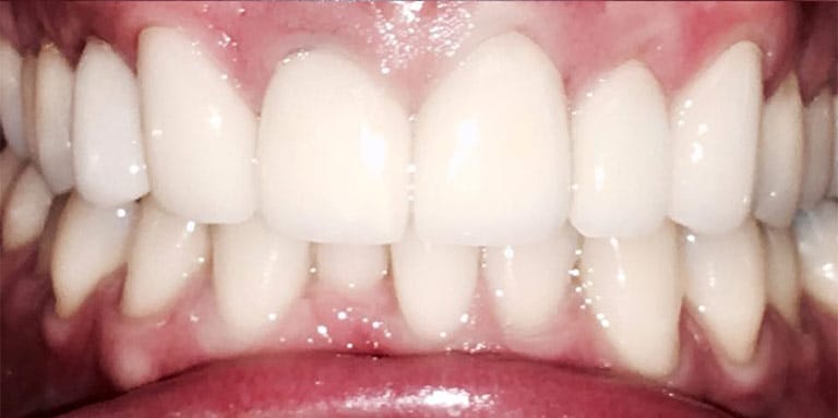 Advanced Dentistry by Soboh Liswi Tedini | Pomona