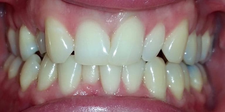 Advanced Dentistry by Soboh Liswi Tedini | Pomona