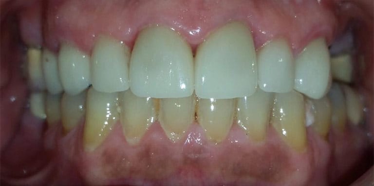 Advanced Dentistry by Soboh Liswi Tedini | Pomona