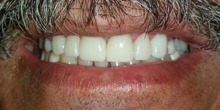 Advanced Dentistry by Soboh Liswi Tedini | Pomona