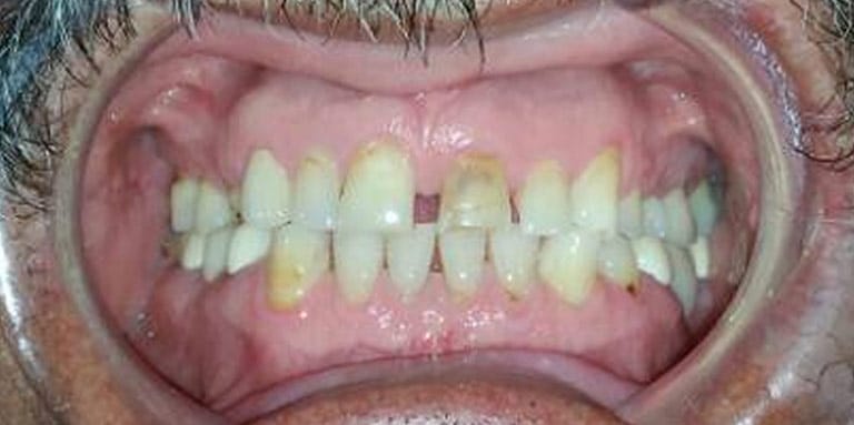 Advanced Dentistry by Soboh Liswi Tedini | Pomona