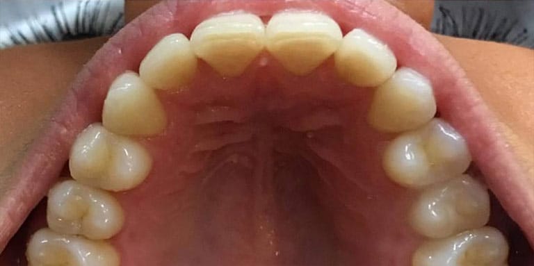 Advanced Dentistry by Soboh Liswi Tedini | Pomona