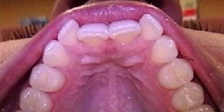 Advanced Dentistry by Soboh Liswi Tedini | Pomona