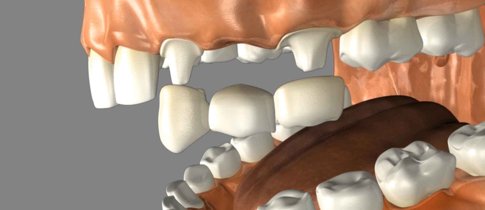 Advanced Dentistry by Soboh Liswi Tedini | Pomona