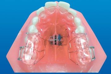 Advanced Dentistry by Soboh Liswi Tedini | Pomona